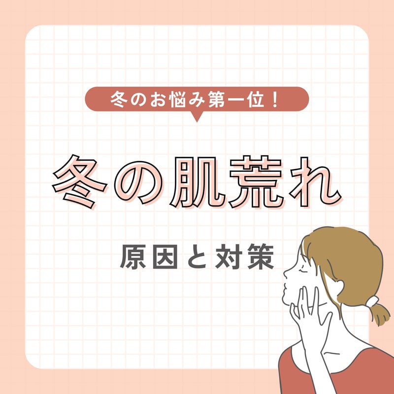 megumi￤おしゃれかわいいテンプレート𓅿𓈒 𓂂𓏸 – Canva